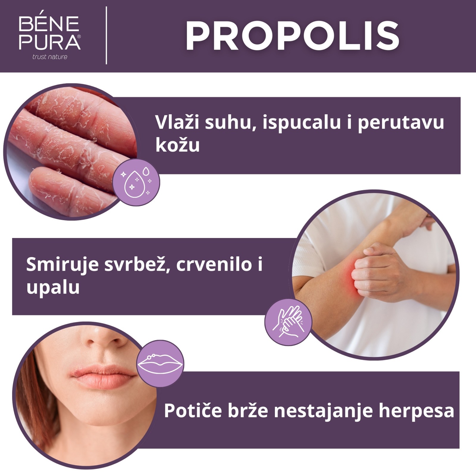 ᐉ Mast za Svrbež s 30% Propolisom - 40ml - Benepura.hr