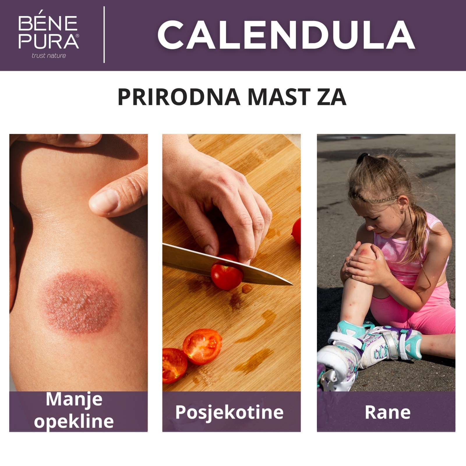 ᐉ Mast za Opekline i Rane s Nevenom - 40ml - Benepura.hr